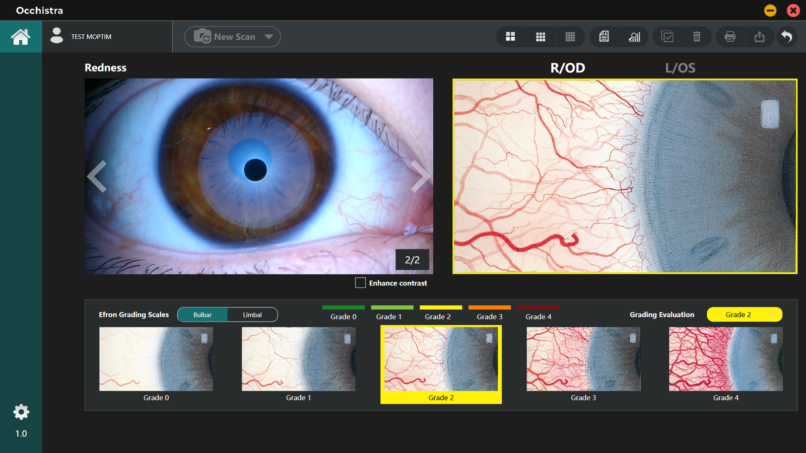 DEA Dry Eye Analyzer | Dry Eye Diagnostics